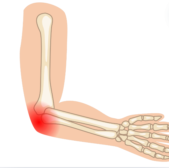 elbow arthroscopy - Doctors